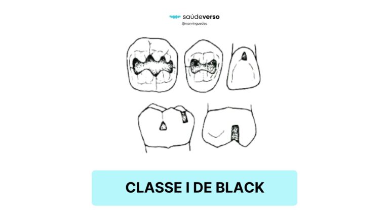 Classificação de Black: Todas as Classes Explicadas