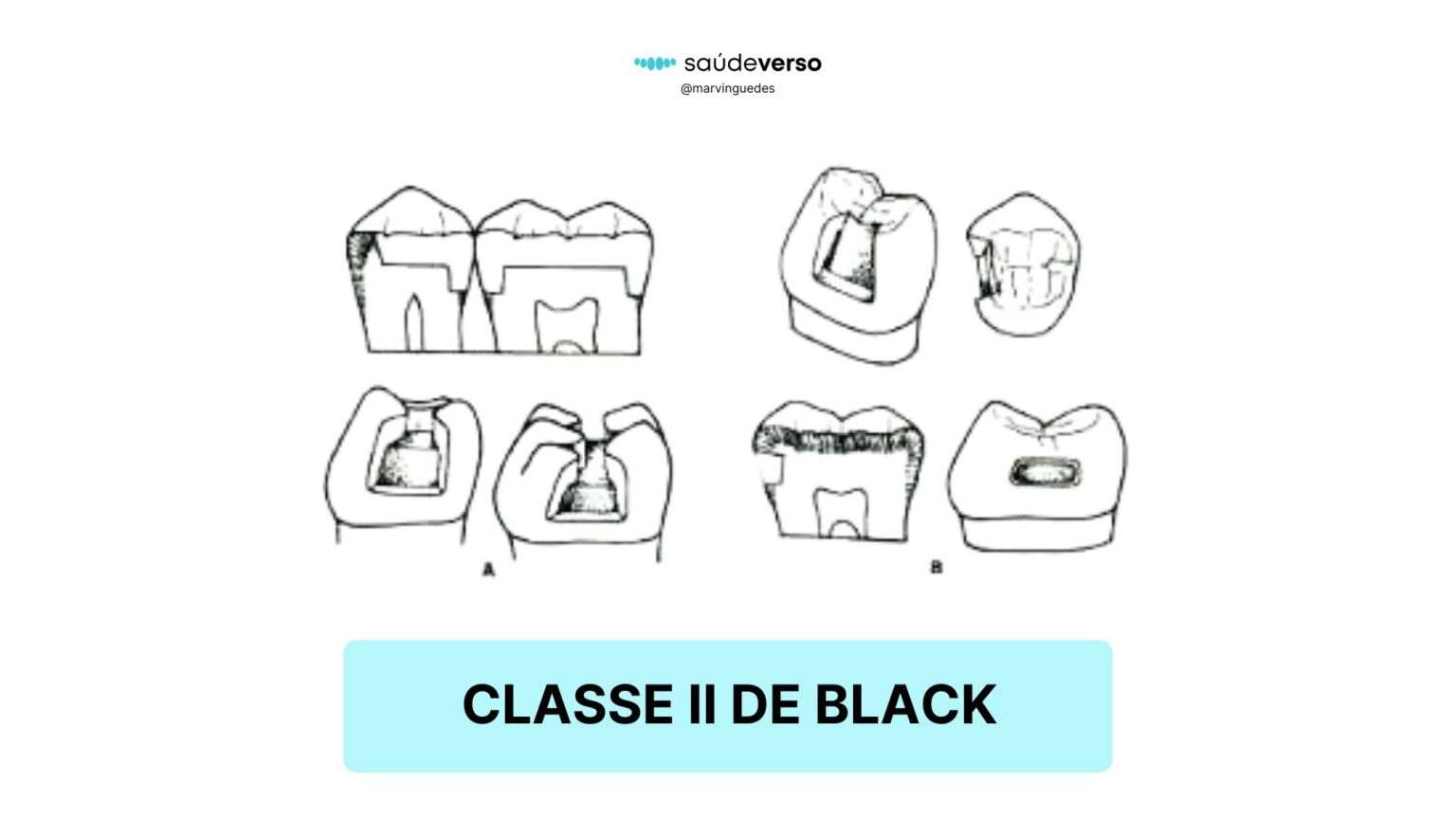 Classificação de Black: Todas as Classes Explicadas