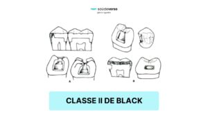 Classificação de Black: Todas as Classes Explicadas