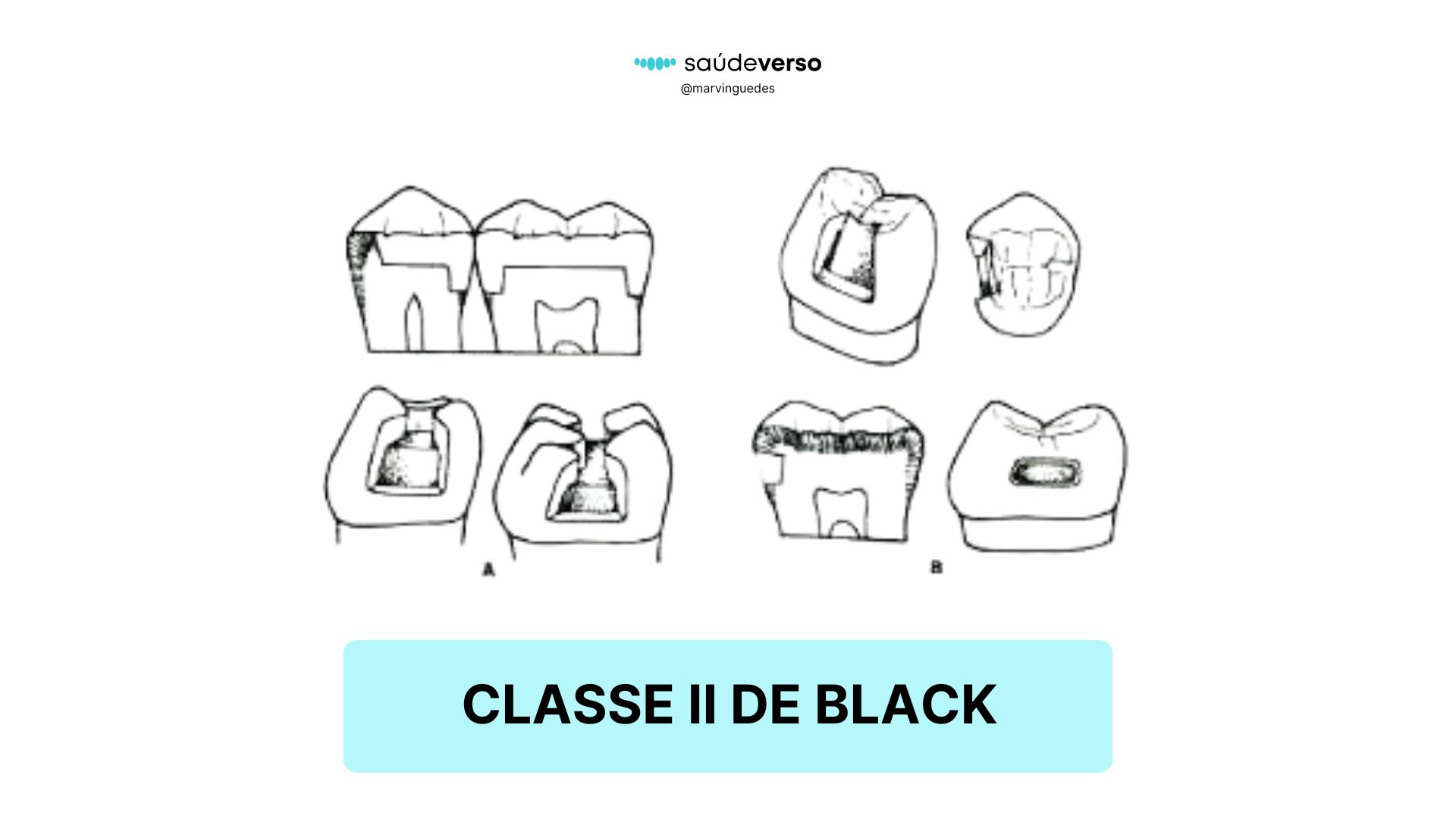 Classificação de Black: Todas as Classes Explicadas