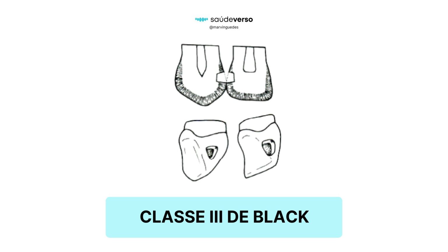 Classificação de Black: Todas as Classes Explicadas