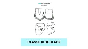 Classificação de Black: Todas as Classes Explicadas