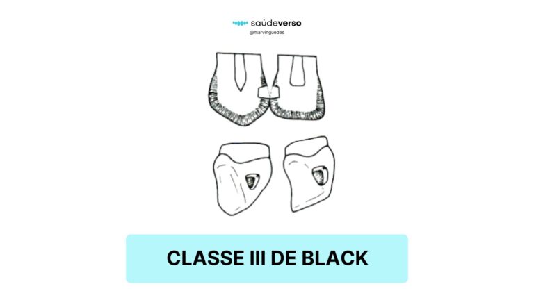 Classificação de Black: Todas as Classes Explicadas