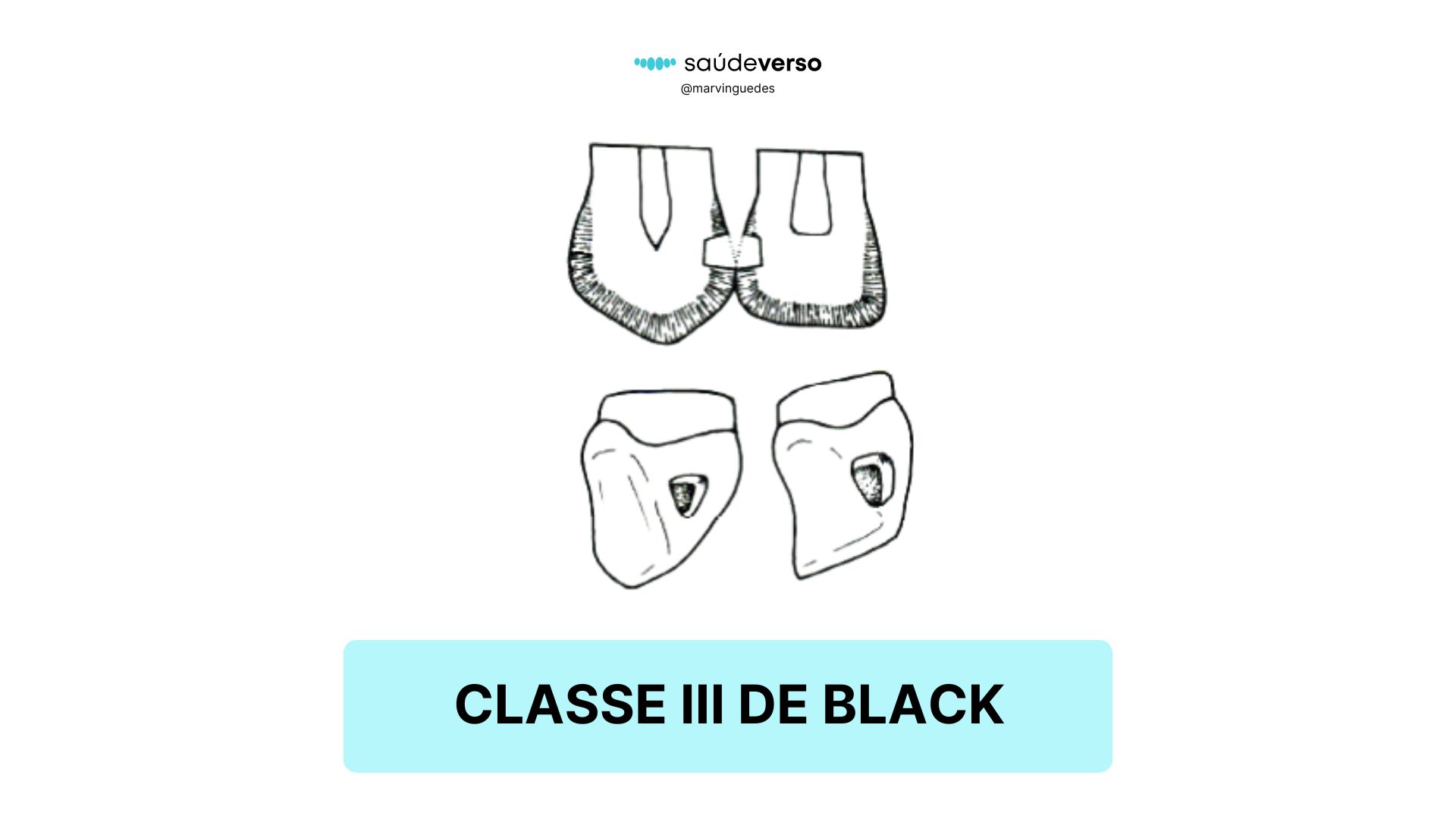 Classificação de Black: Todas as Classes Explicadas
