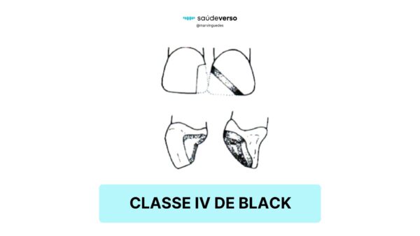 Classificação de Black: Todas as Classes Explicadas