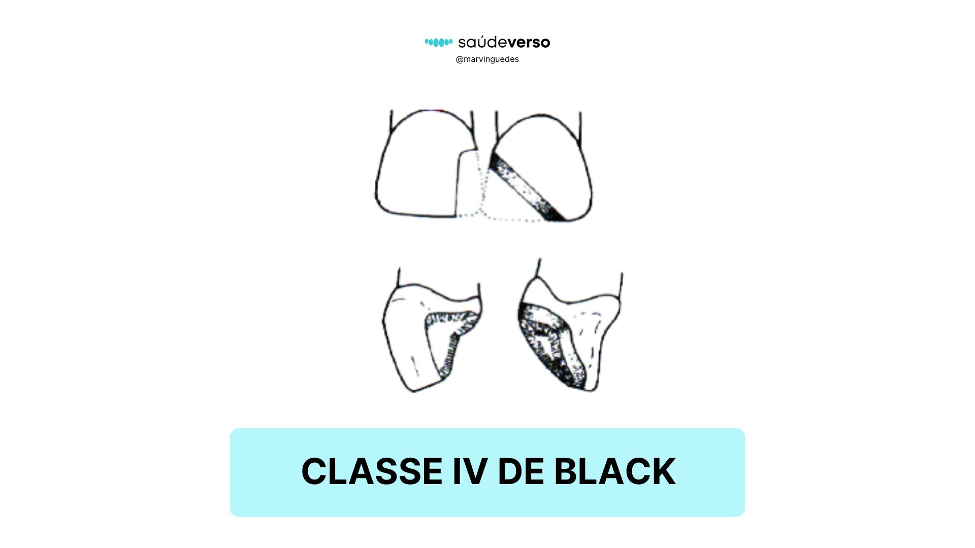 Classificação de Black: Todas as Classes Explicadas