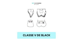 Classificação de Black: Todas as Classes Explicadas