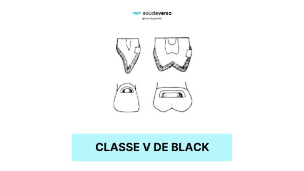 Classificação de Black: Todas as Classes Explicadas