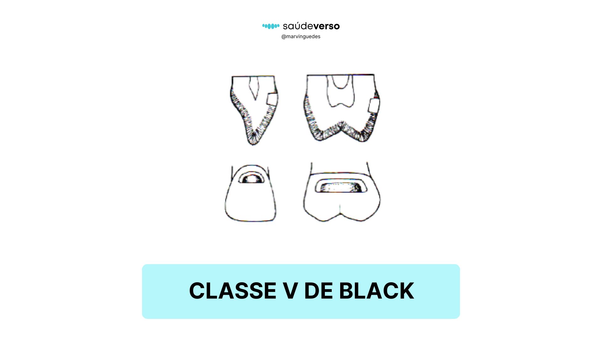 Classificação de Black: Todas as Classes Explicadas